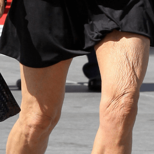 Golden Tree Bloom | Hidratáló testápoló krém a feszes bőrért